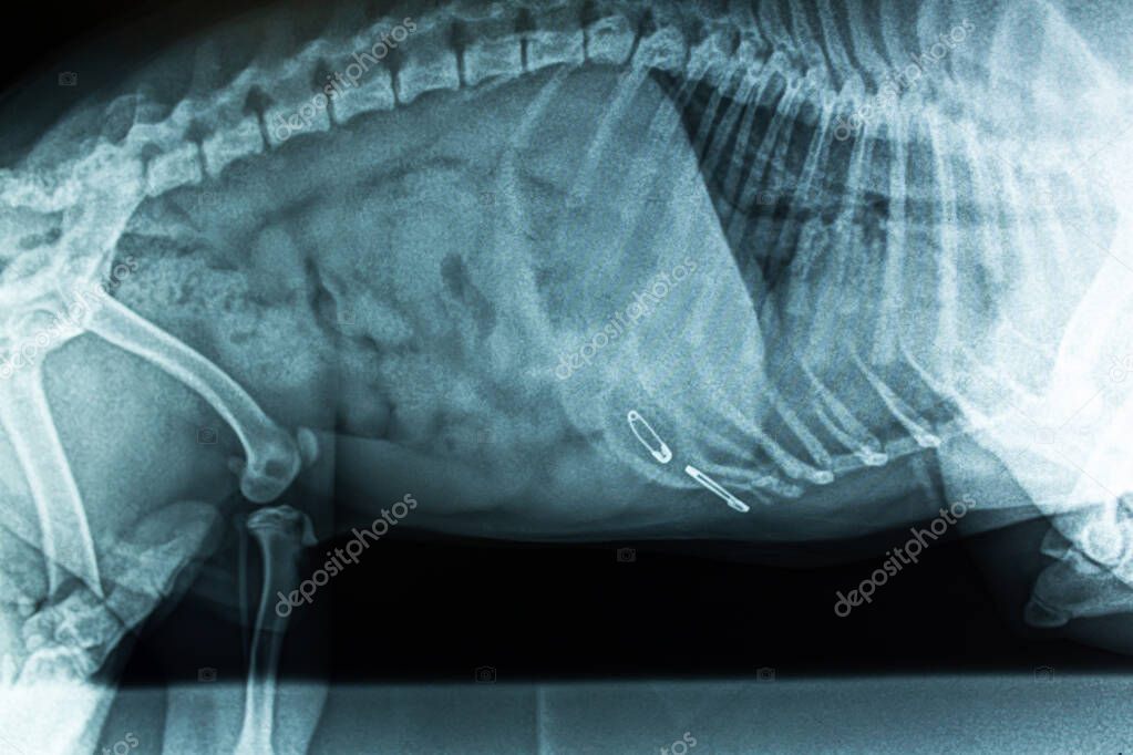 Imagen de rayos X de la cavidad abdominal. Alfileres en el estómago del ...