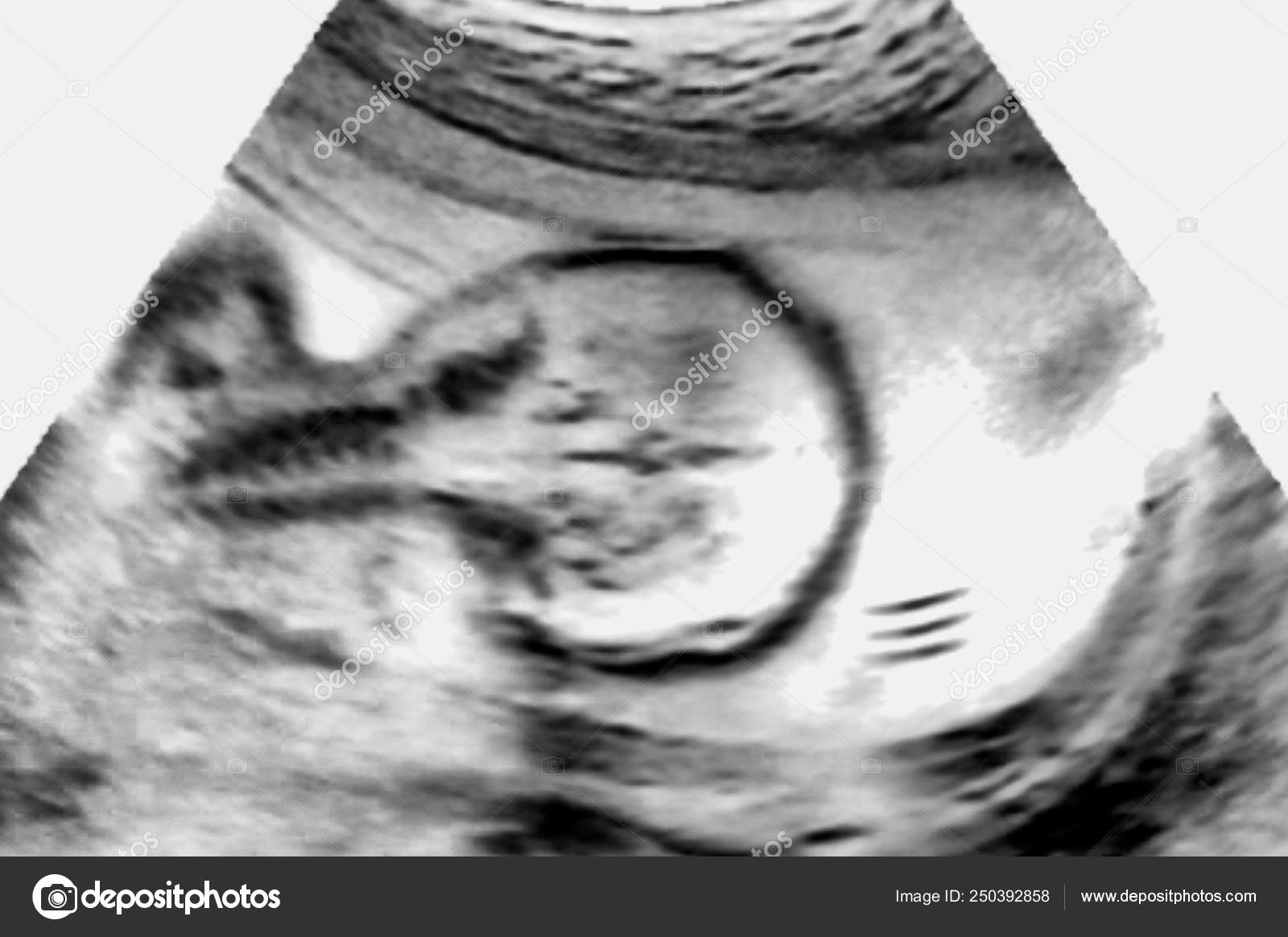 Embryo ultrasound. Back view with spine detail — Stock Photo © jovannig ...