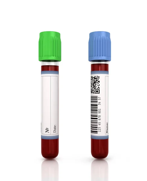 Medical test tubes with blood in a holder on a blue background Stock ...