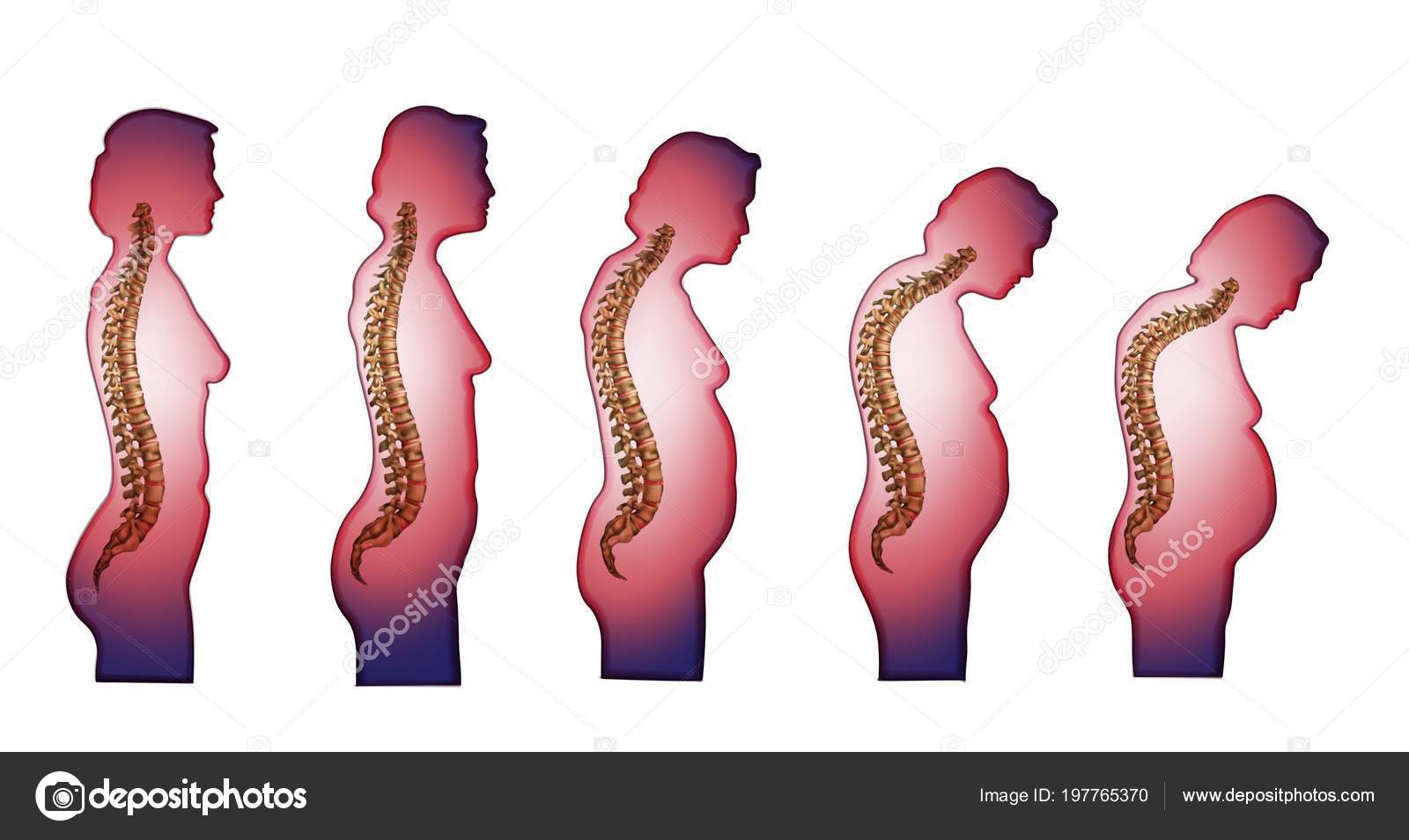 Skeleton_Spine Changing Spine Age Stock Vector Image by ©urfingus ...