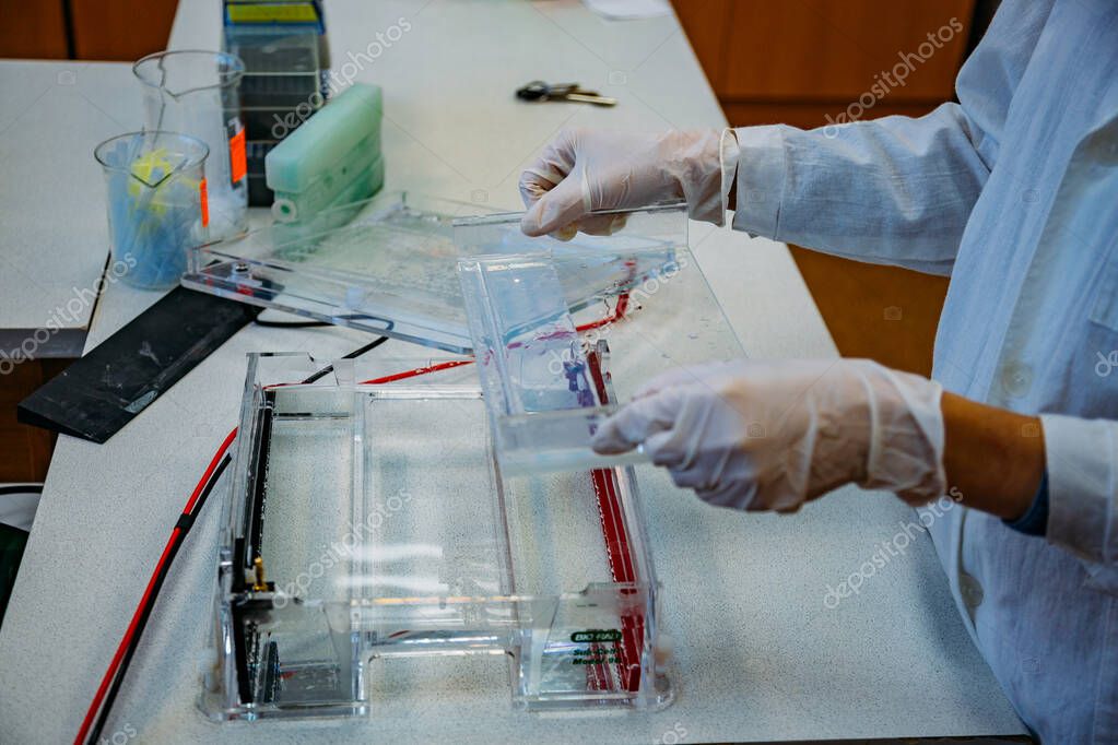 Cargando el gel de agarosa con muestras para la separación de fragmentos de ADN para ...