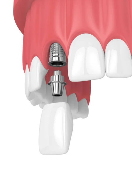 263 illustrations de Culée | Depositphotos