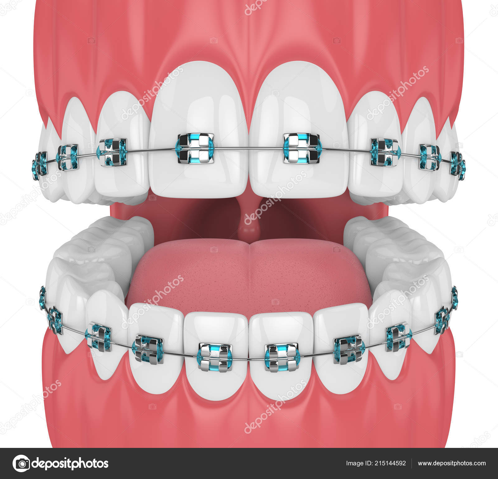 Teeth Braces Background