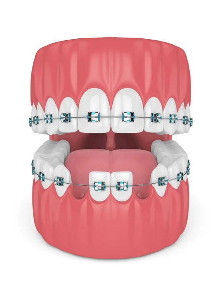 Orthodontic functional Stock Photos, Royalty Free Orthodontic ...