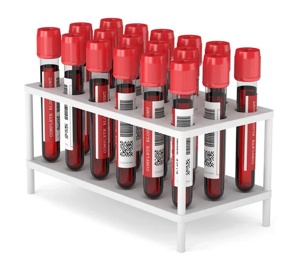 Blood vials rack Stock Photos, Royalty Free Blood vials rack Images ...
