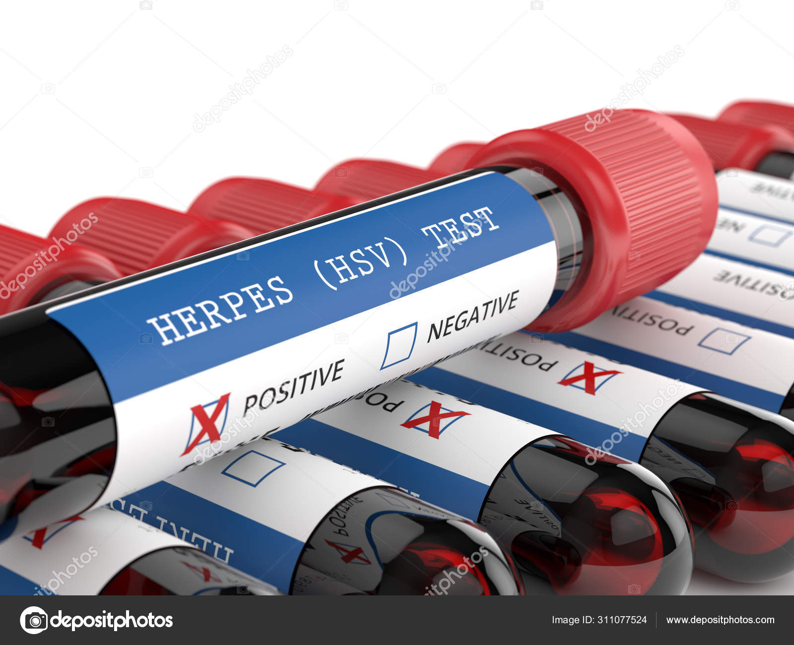 3d render of blood samples with herpes test — Stock Photo © ayo888 ...
