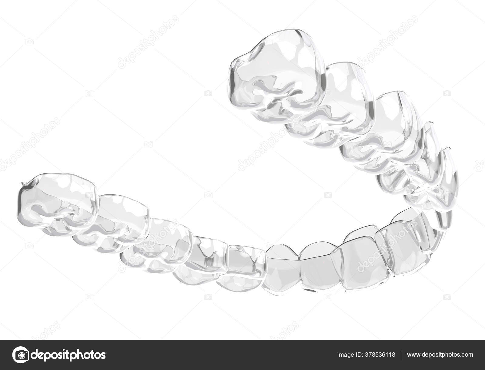 Render Invisalign Removable Invisible Vacuum Formed Retainer White ...