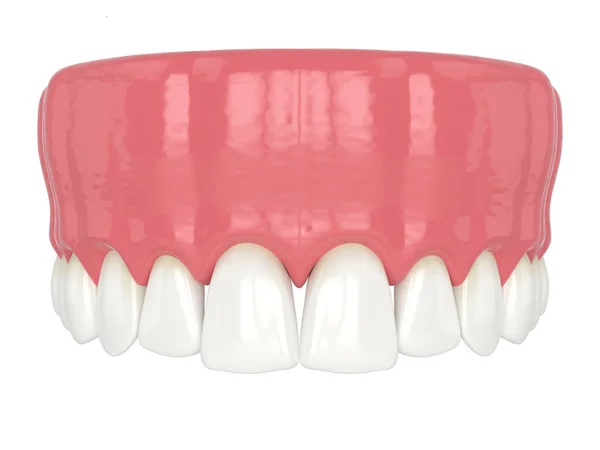 Render Human Upper Jaw Black Triangles Teeth Stock Photo by ©ayo888 ...