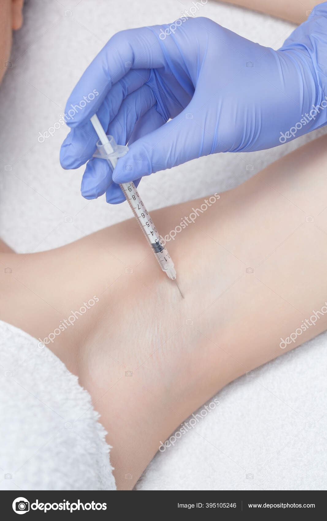 Doctor Makes Intramuscular Injections Botulinum Toxin Underarm Area ...