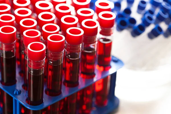 Tabung darah Stok Foto, Tabung darah Gambar Bebas Royalti | Depositphotos