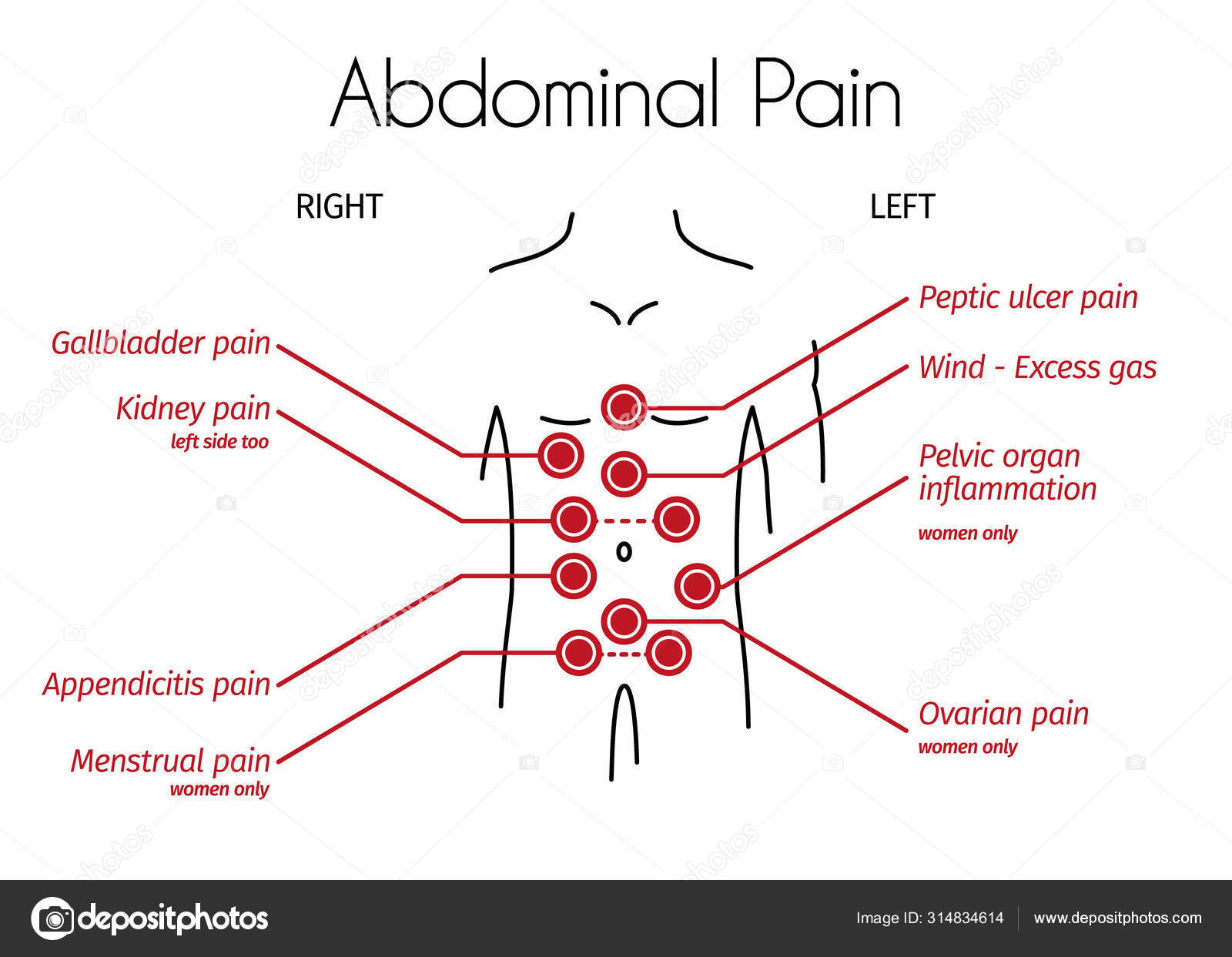 Vector Infographic of Abdominal Pain Types Stock Vector Image by ©Roman ...