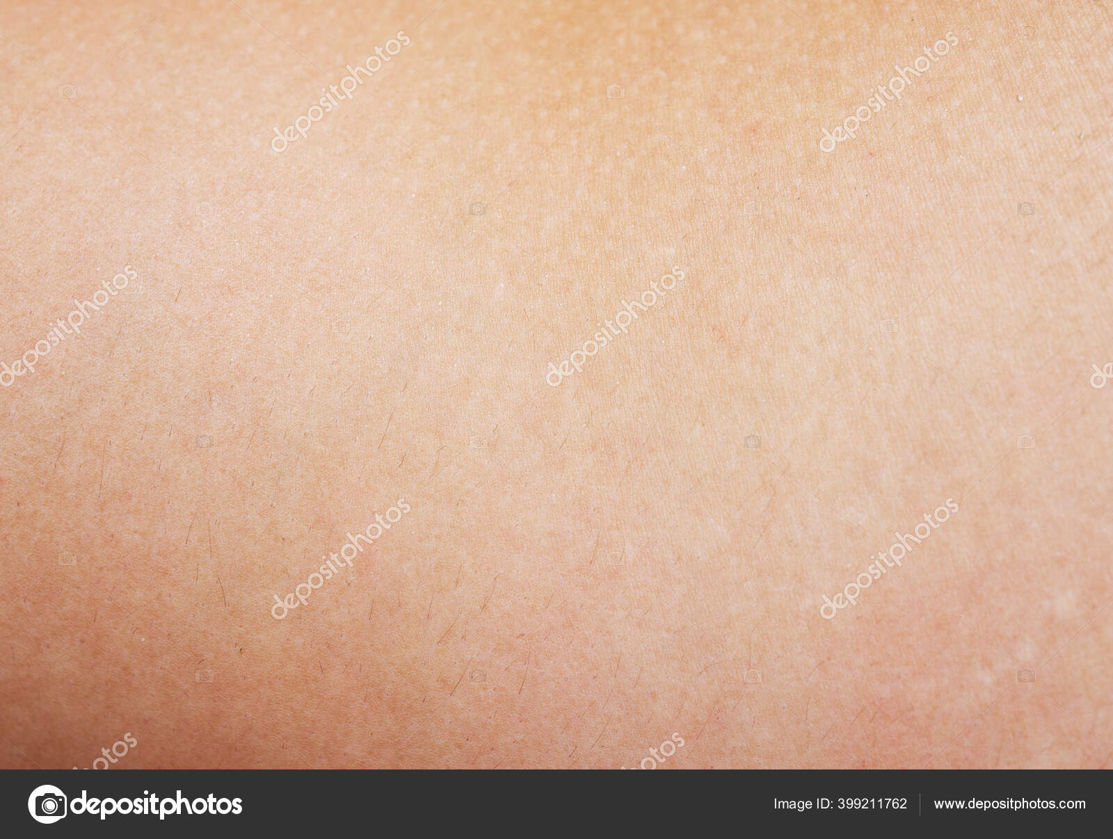 Healthy Human Skin Background — Stock Photo © ruslanchik #399211762