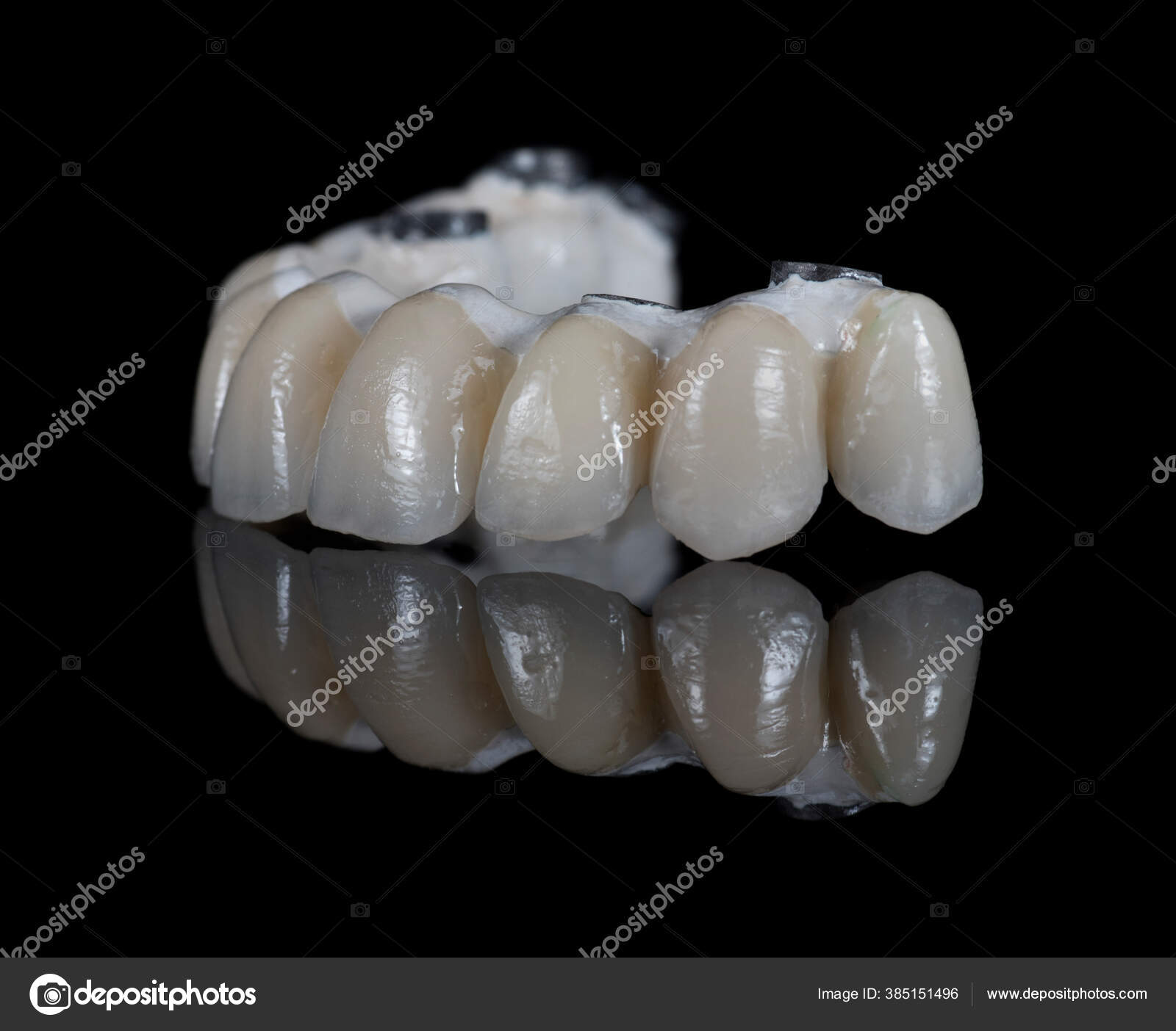 Ceramic Teeth Dental Crowns Model Black Background — Stock Photo ...