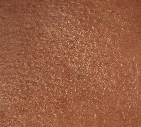 Human skin texture Stock Photo by ©dimarik 192959018