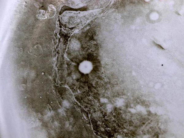 Germs under the microscope Stock Photos, Royalty Free Germs under the ...