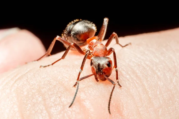 Ant bite Stock Photos, Royalty Free Ant bite Images | Depositphotos