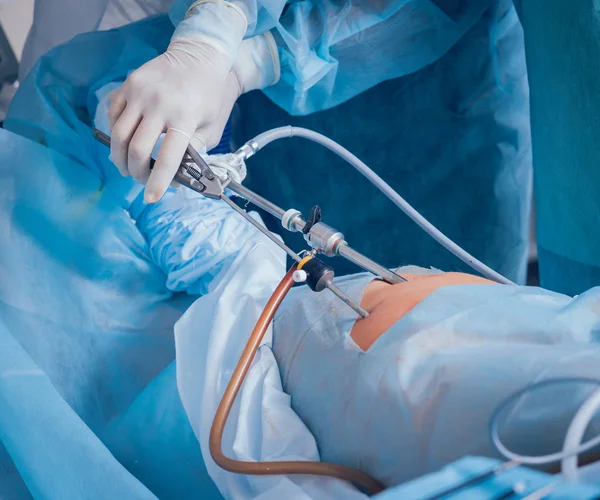 Process of gynecological surgery operation using laparoscopic equipment ...