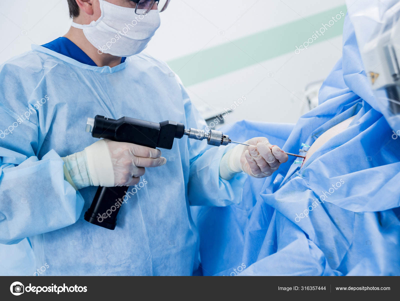 Arthroscope Surgery Orthopedic Surgeons Teamwork Operating Room Modern ...