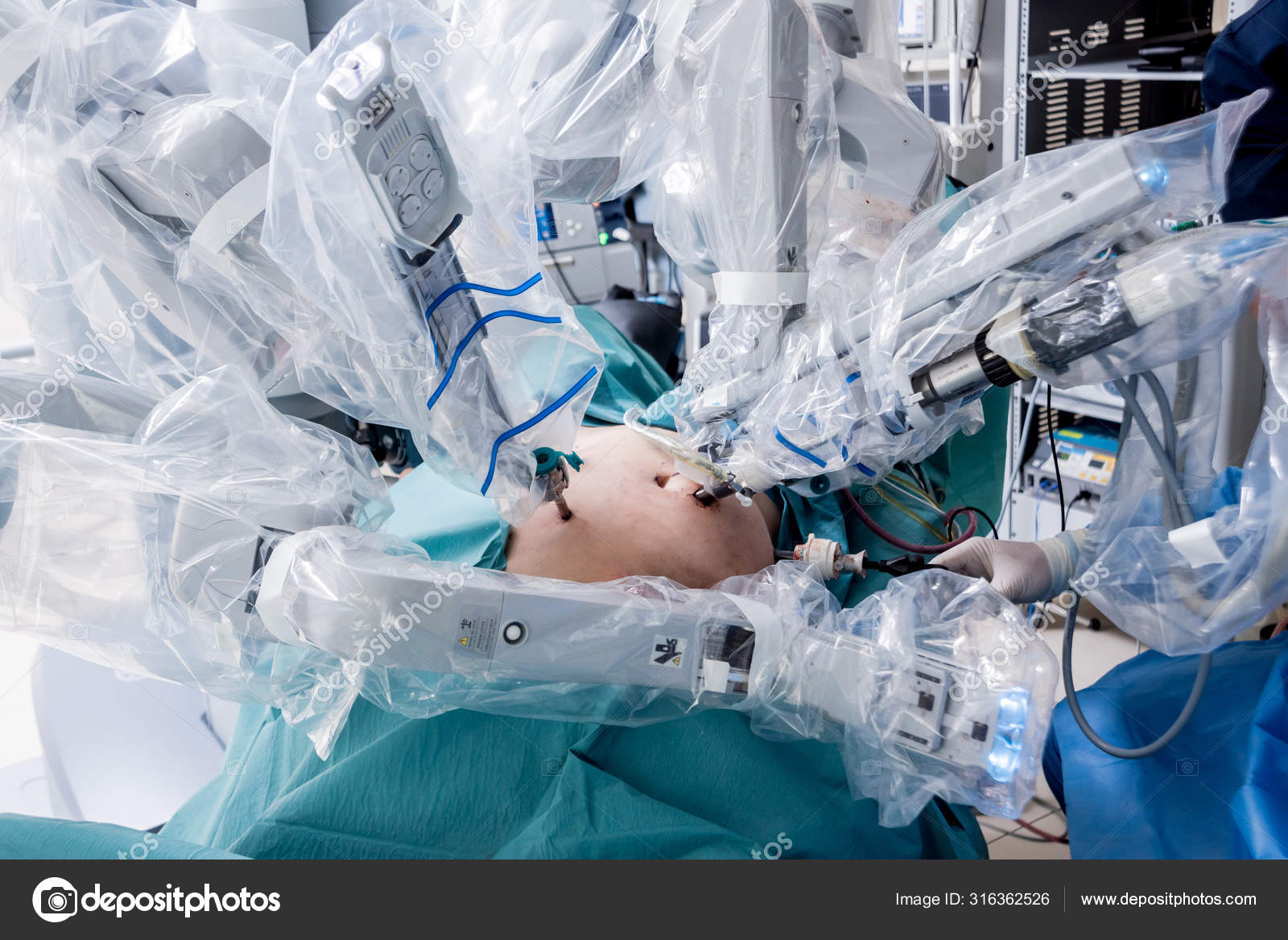 Sistema Quirúrgico Moderno Robot Médico Cirugía Robótica Mínimamente ...