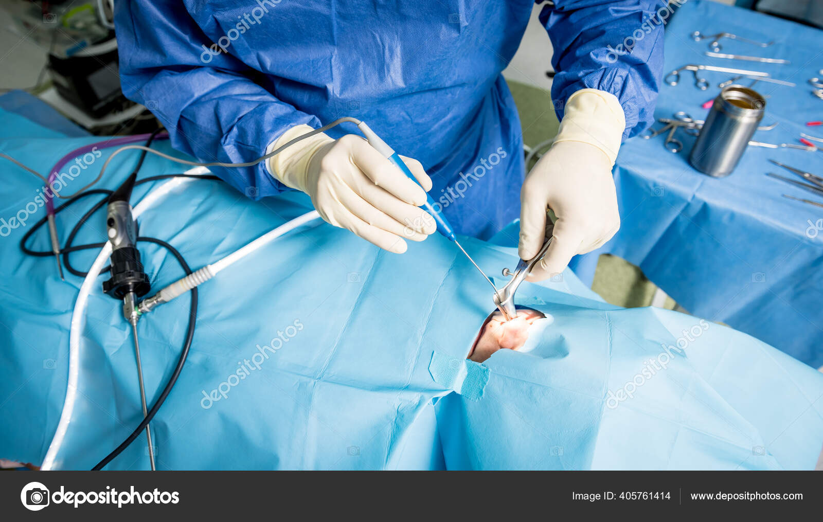 Rinocerurgia funcional para restaurar la respiración nasal con tecnología de coblación. — Foto ...