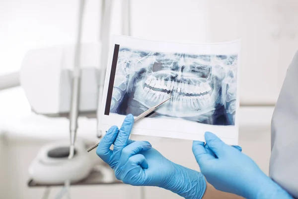 Procedimiento de implante dental fotos de stock, imágenes de Procedimiento de implante dental ...