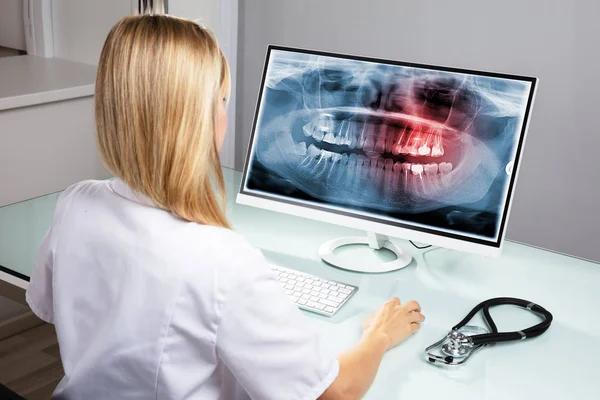 Female Dentist Examining Teeth X-ray On Computer Over Desk In Clinic ...