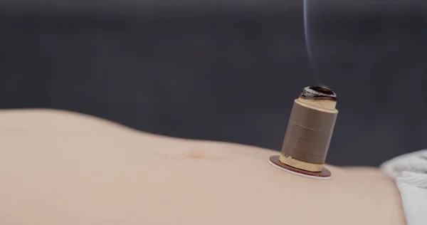 Traditional Chinese Medicine Moxibustion Therapy Stock Photo by ©leungchopan 220694944