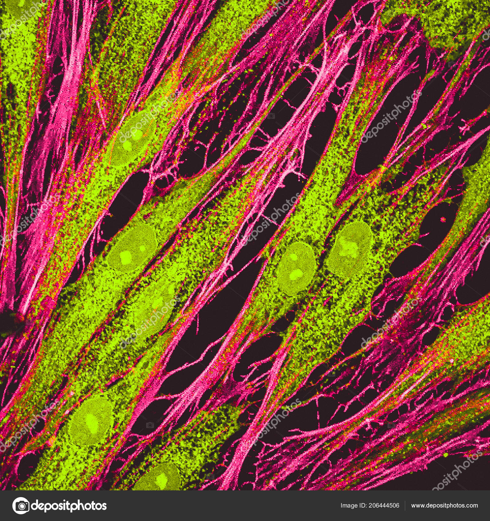 Skin Cells Under Microscope Labeled