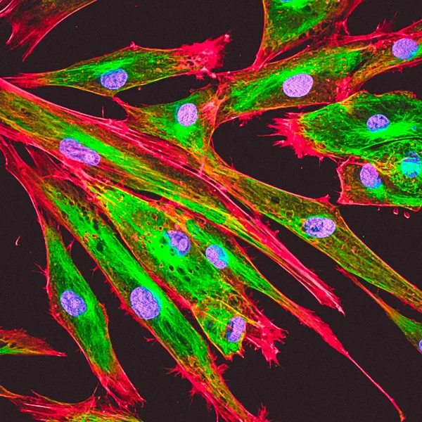 Confocal microscopy of fibroblast cells — Stock Photo © vshivkova ...