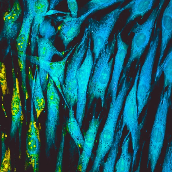 Cell staining Stock Photos, Royalty Free Cell staining Images ...