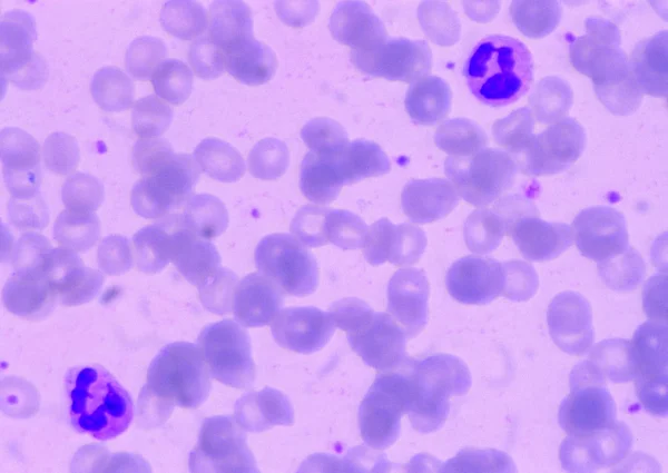 Lymphocyte — Stock Photo © toeytoey #63120063