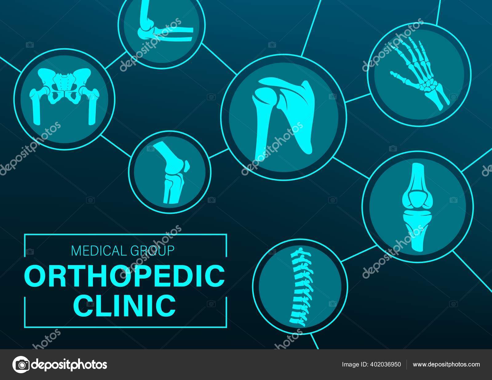 Orthopedics Joints Rheumatic Disorder Medical Health Care Vector Human ...