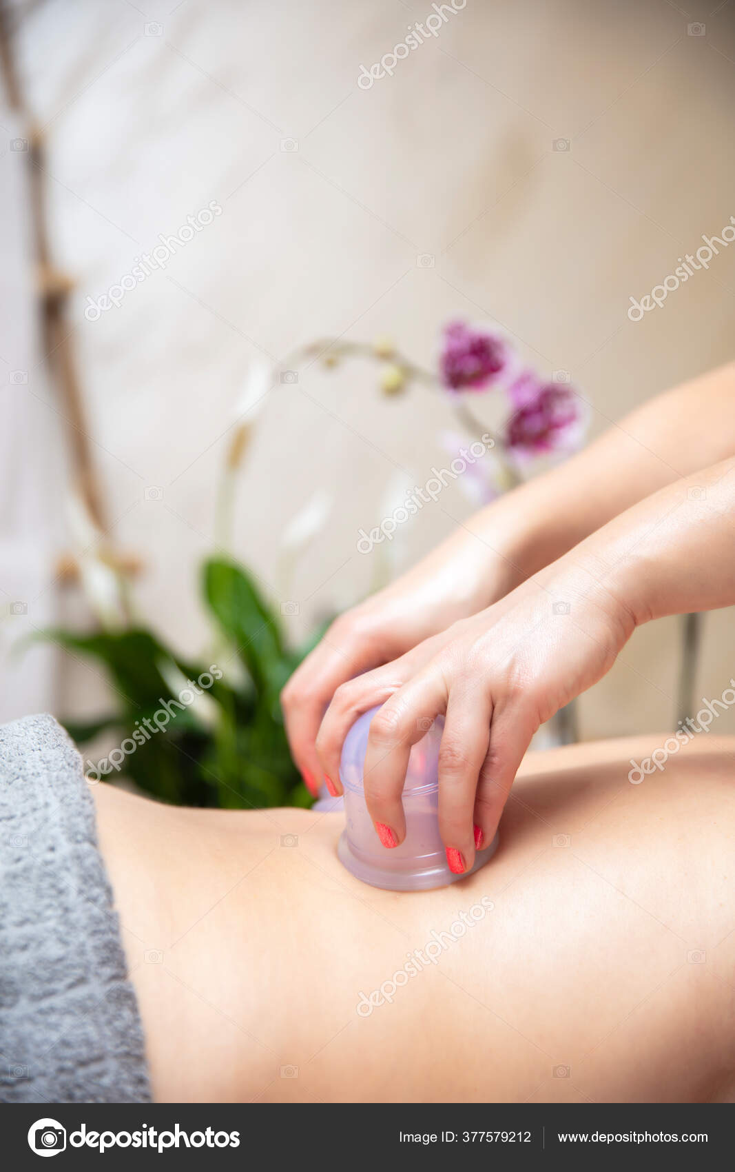 Closeup Cups Applied Back Skin Female Patient Part Traditional Method ...