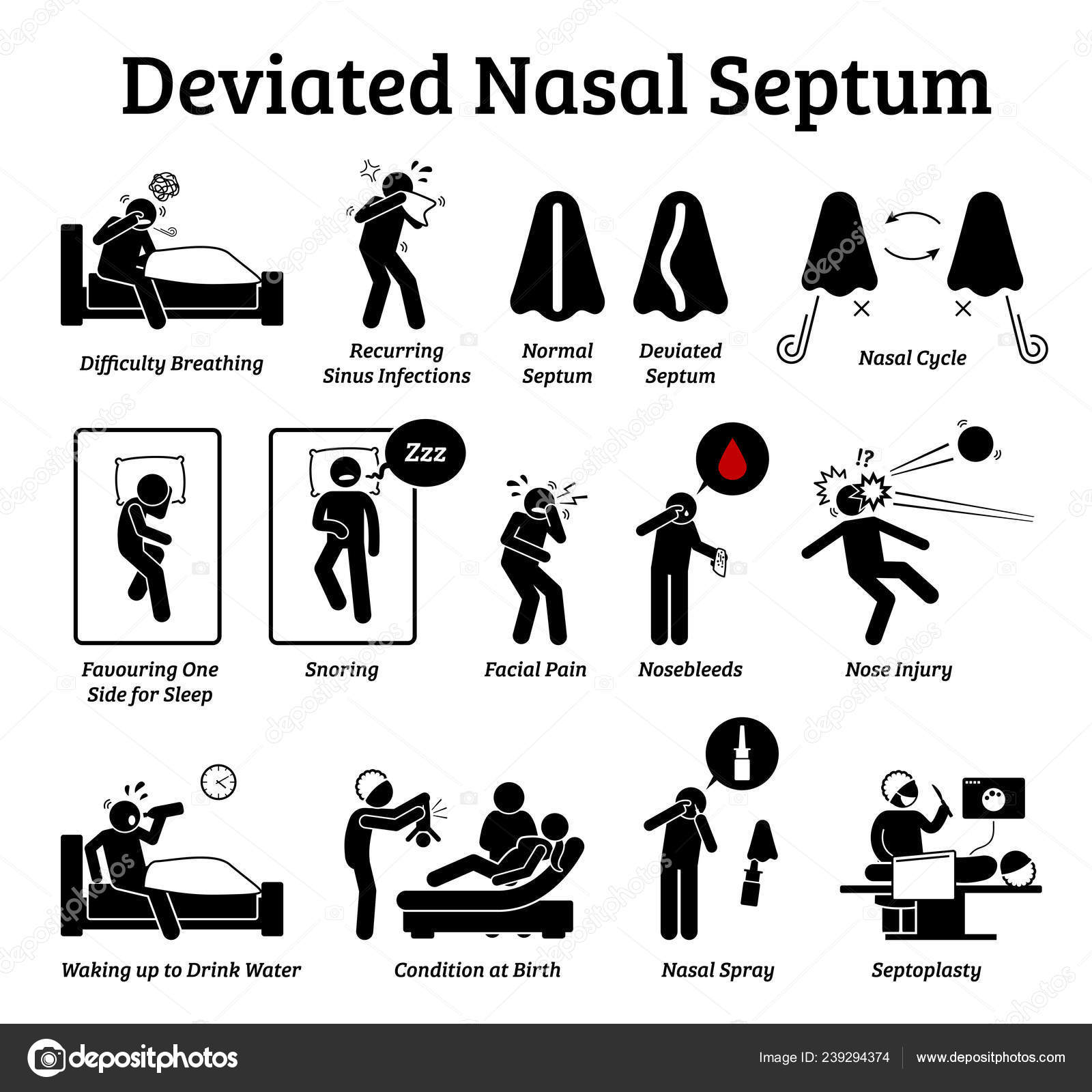 Deviated Septum Symptoms Do You Know These 7 Signs Deviated Septum