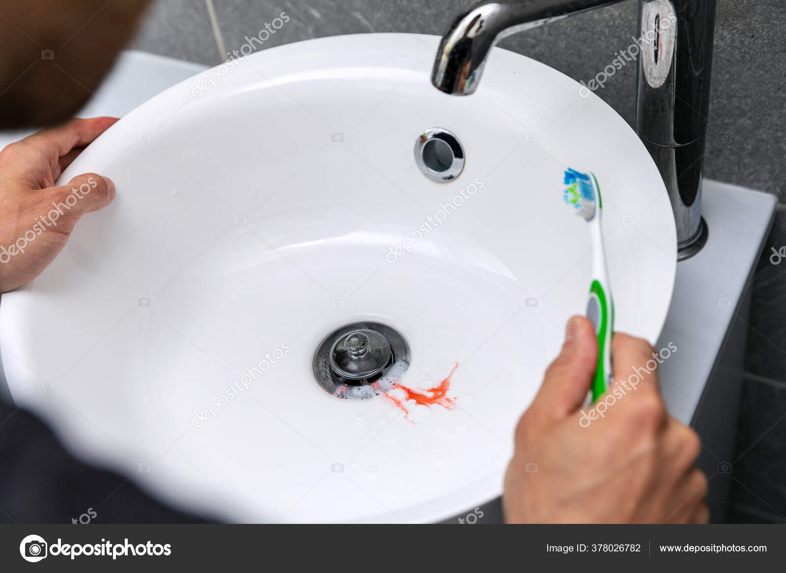 Man Have Bleeding Gums While Brushing Teeth Tooth Decay Gingvitis Stock ...