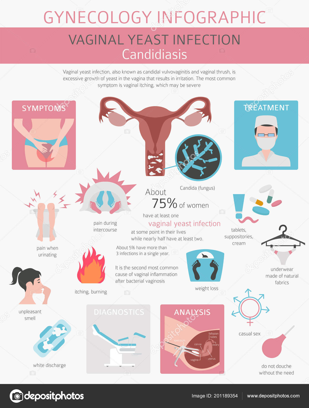 Infección Vaginal Por Levaduras Candidiasis Infografía Ginecológica ...
