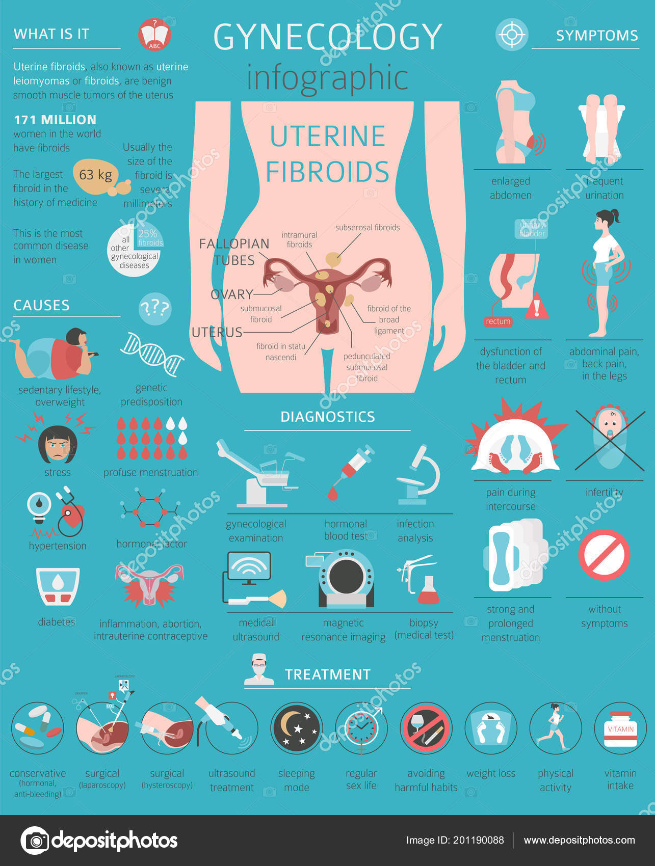 Uterine Fibroids Ginecological Medical Desease Women Infographic Vector