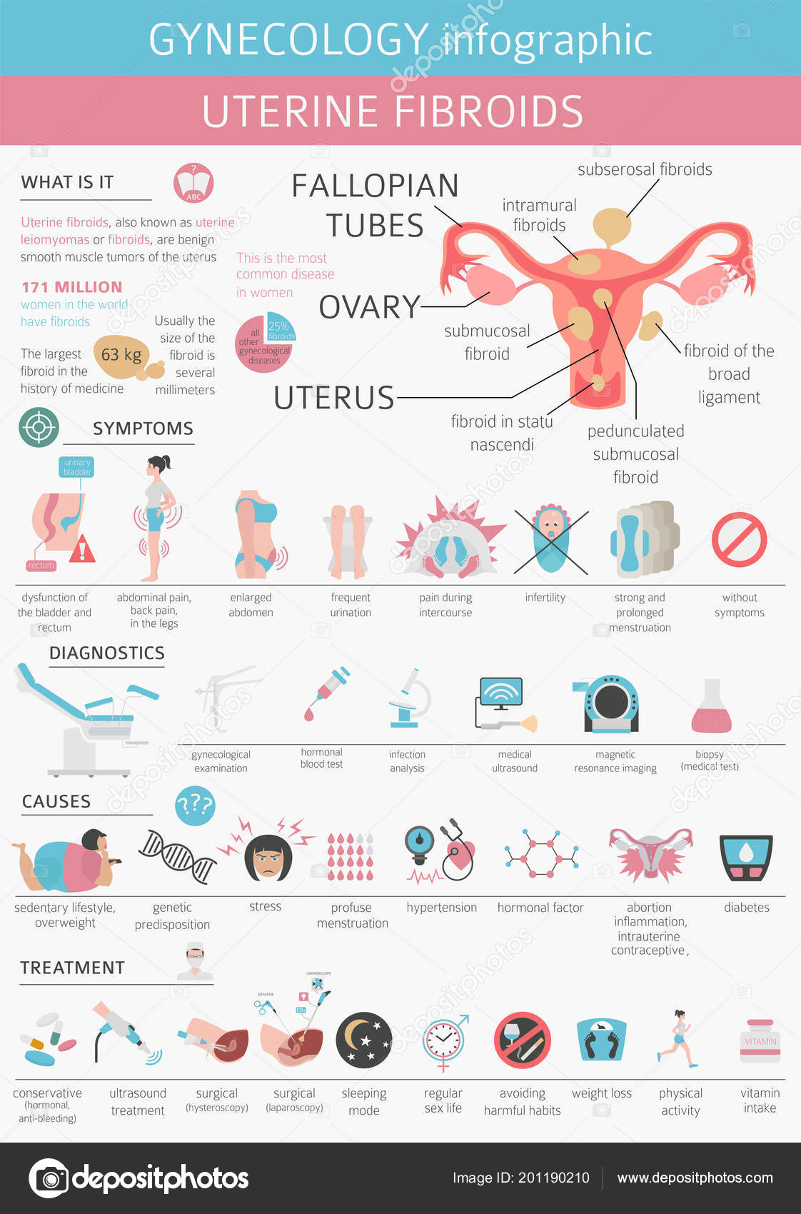 Uterine Fibroids Ginecological Medical Desease Women Infographic Vector