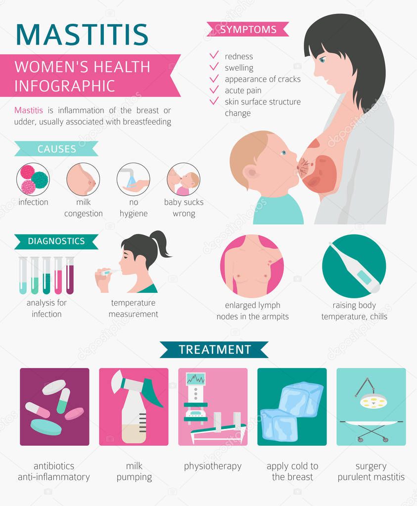 Mastitis, lactancia materna, infografía médica. Diagnósticos, síntomas, tratamiento. Conjunto de ...