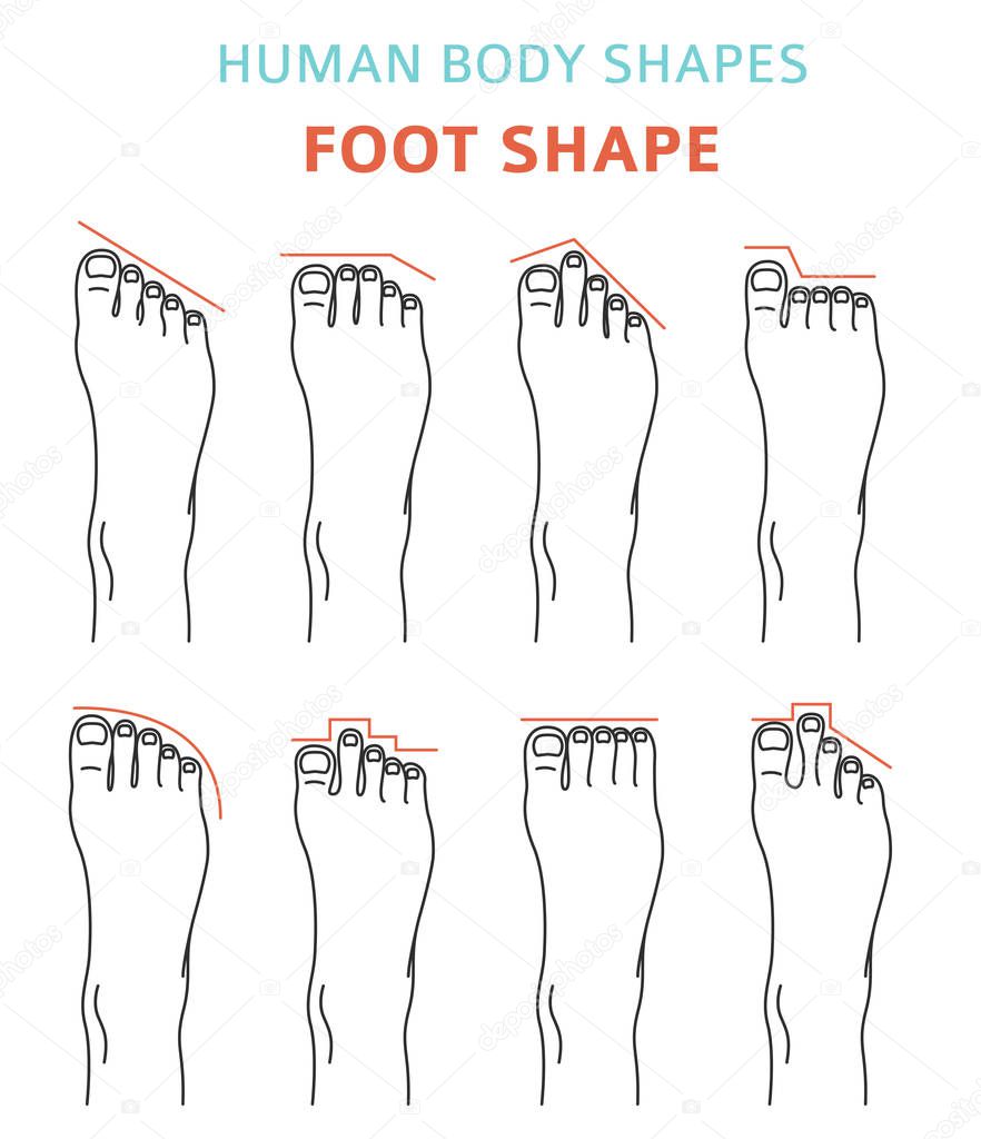 Forma del cuerpo humano.Tipos de pies conjunto de iconos. Ilustración ...