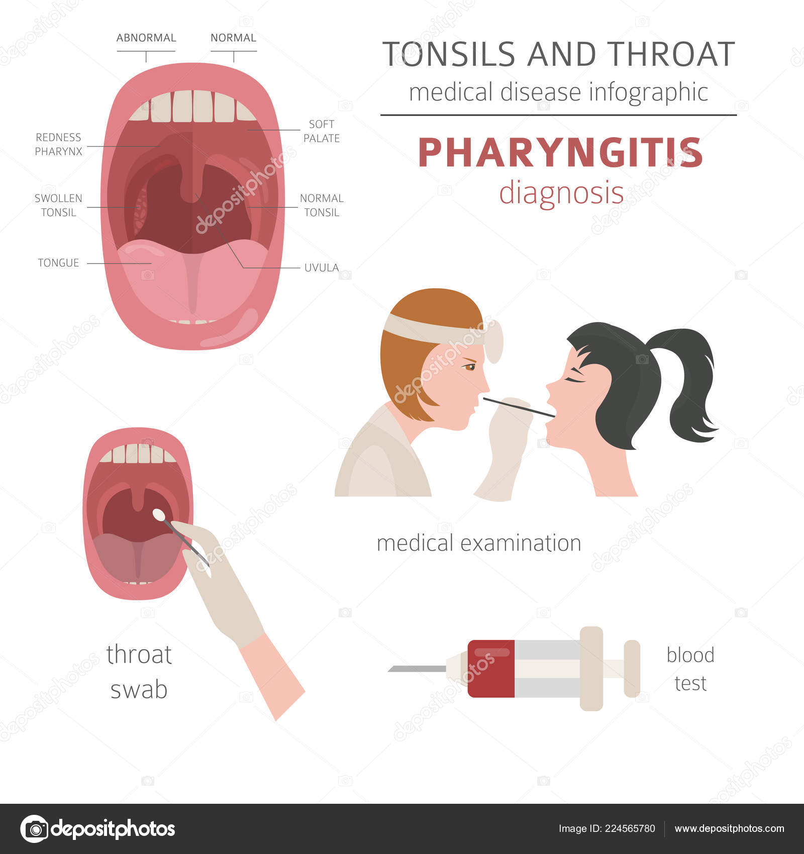 Normal Tonsils Vs Abnormal