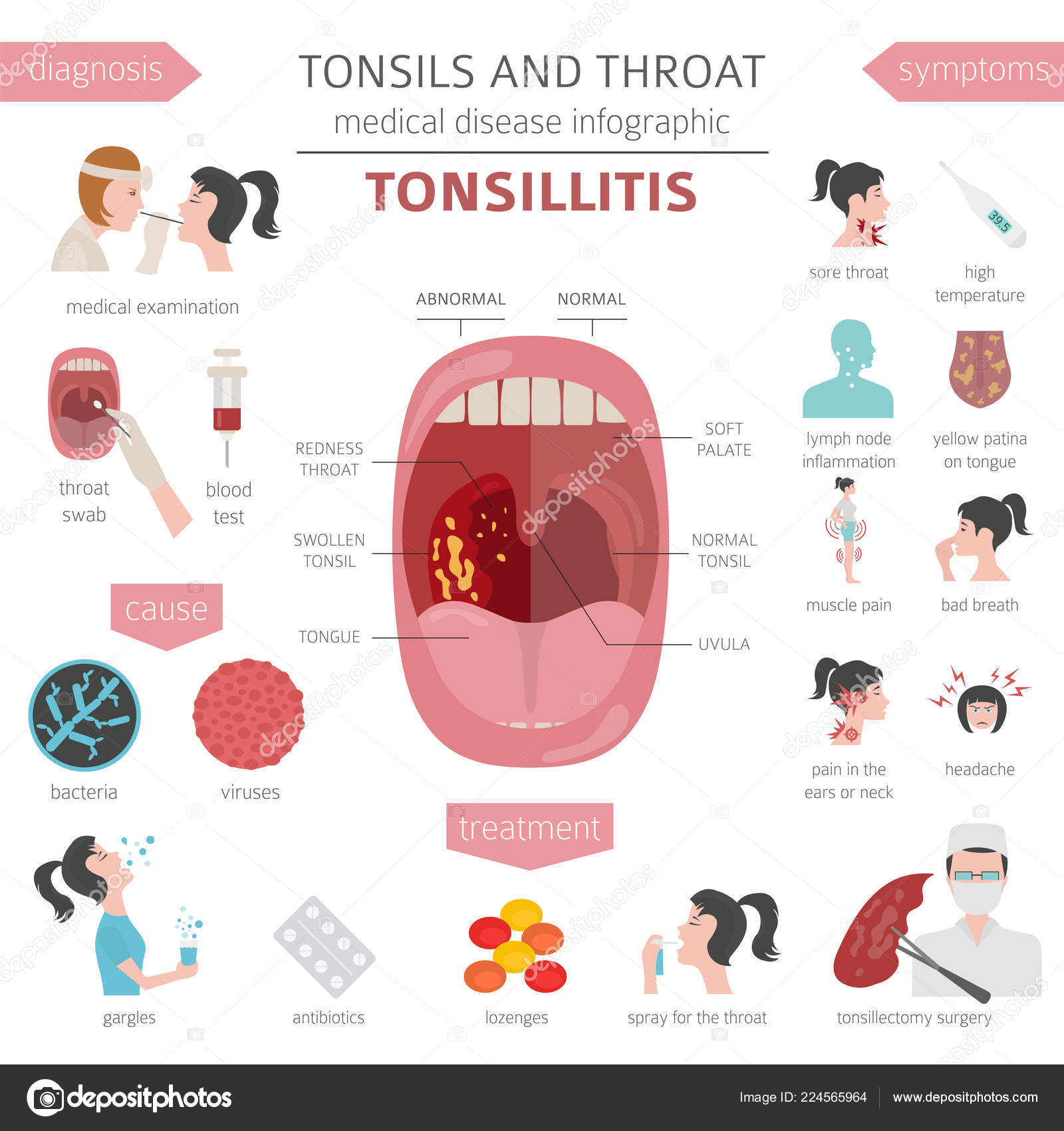 Tonsils Throat Diseases Tonsillitis Symptoms Treatment Icon Set Medical ...