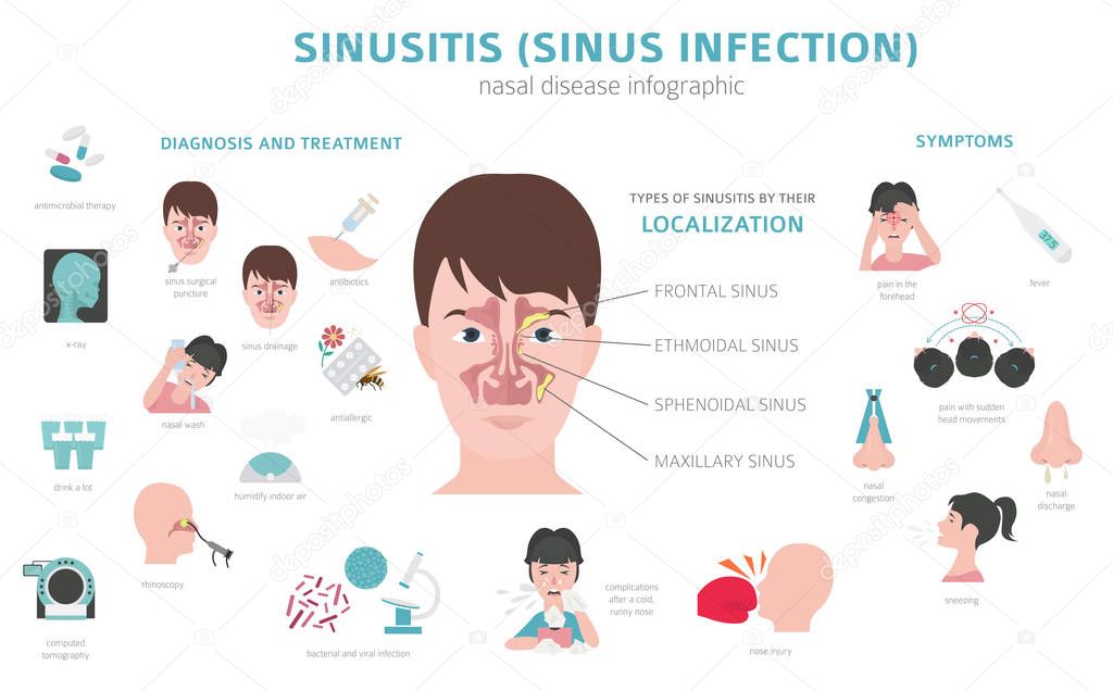 Enfermedades nasales. Sinusitis, diagnóstico y tratamiento de la ...