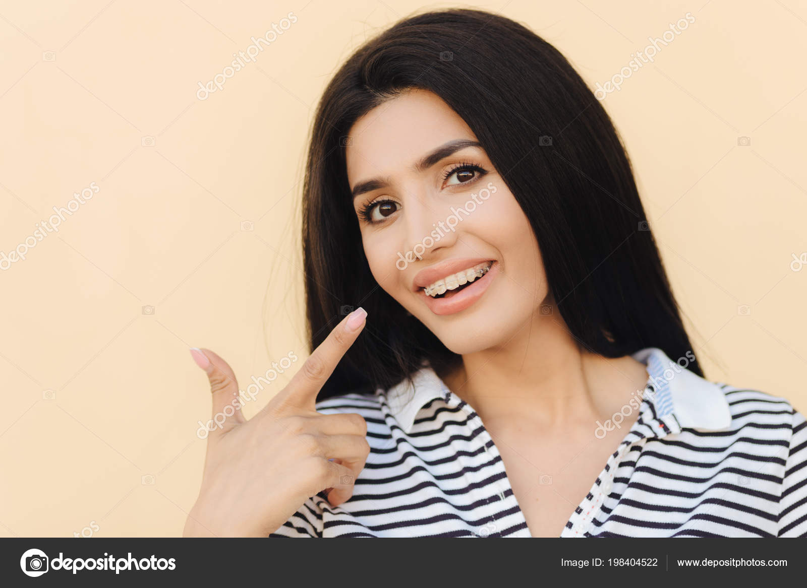 Good Looking Female Luxurious Dark Hair White Teeth Brackets Indicates ...