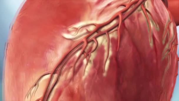 22 Acute myocardial infarction Videos, Royalty-free Stock Acute ...