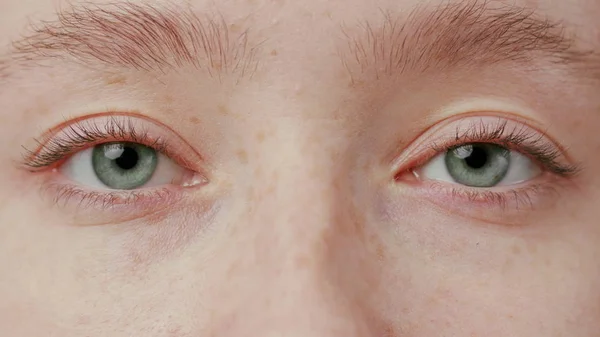 Albinism eye Stock Photos, Royalty Free Albinism eye Images | Depositphotos