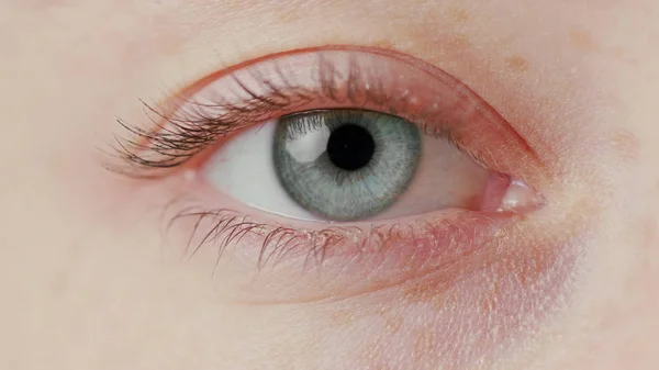 Albinism eye Stock Photos, Royalty Free Albinism eye Images | Depositphotos