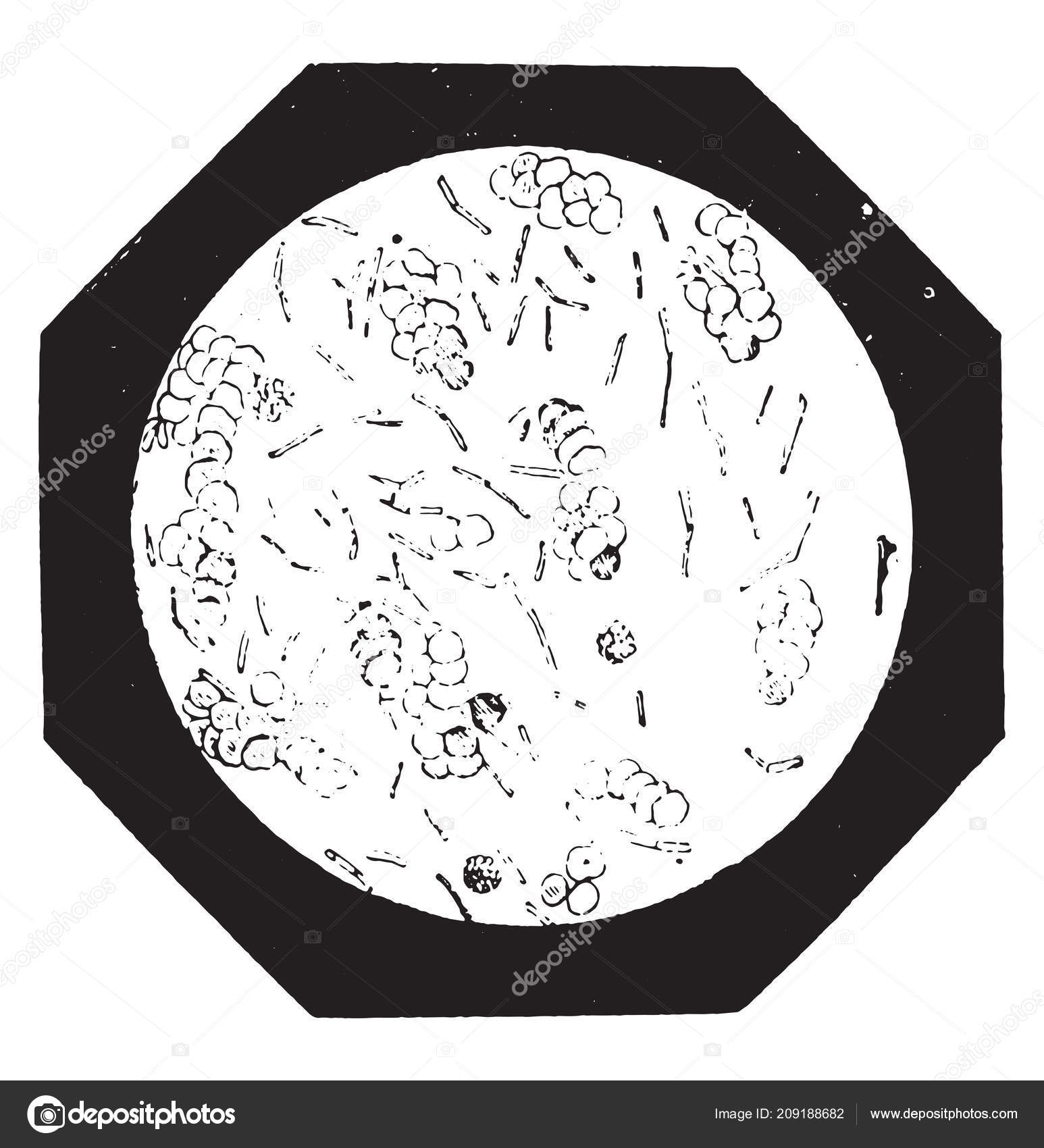 Anthrax, vintage engraving. Stock Vector Image by ©Morphart #209188682