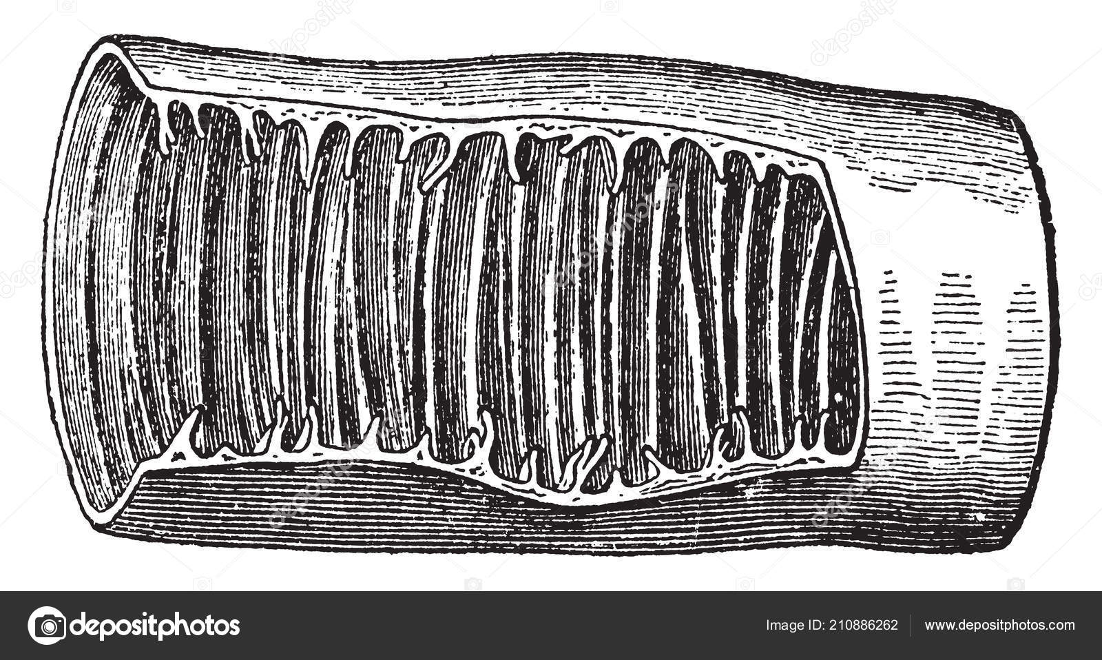 Diagram Represents Small Intestine Portion Vintage Line Drawing ...