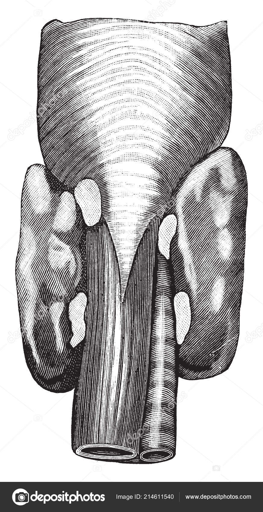 Denne Illustration Repræsenterer Parathyroid Kirtel Vintage Linje ...